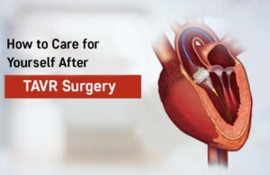 How to Care for Yourself After TAVR Surgery